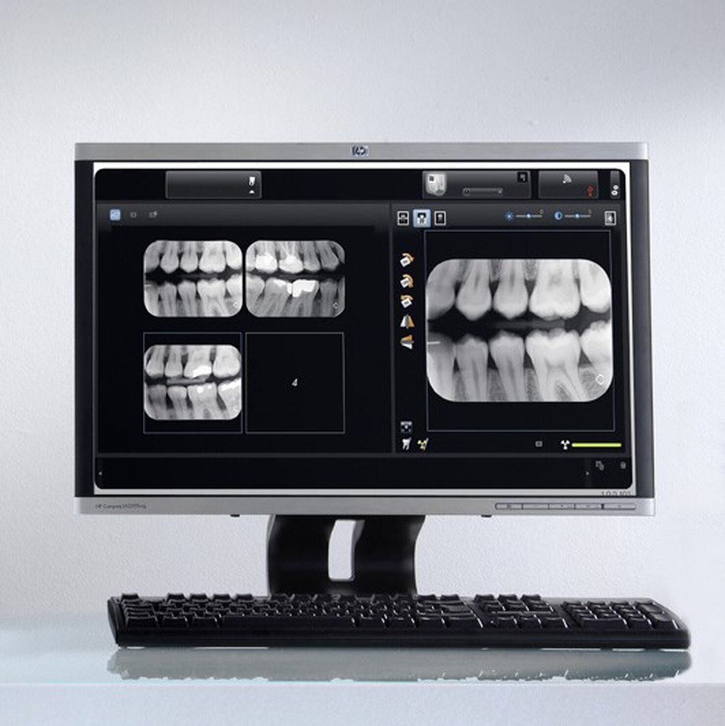 scanner fosfori Carestream CS 7600