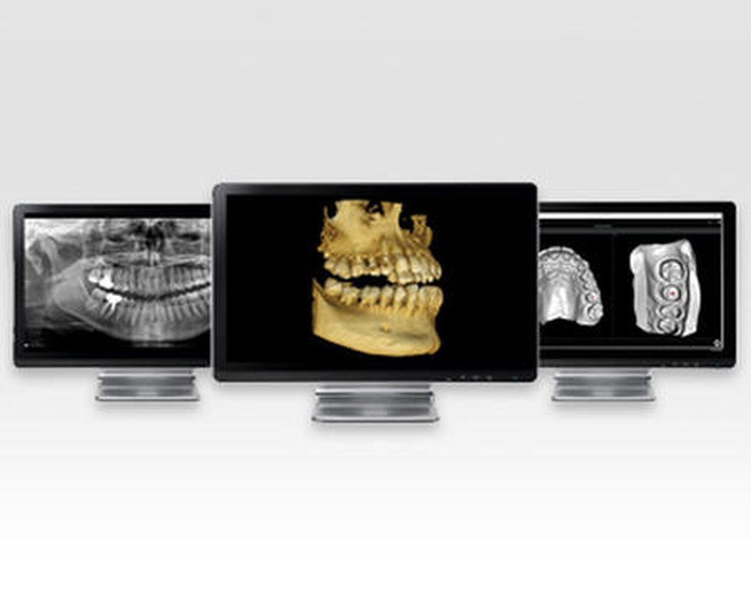 Carestream CS 8100 3D