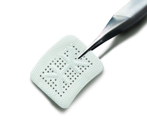 Membrana Cytoplast RPM De Ore - Membrane e sistemi di fissaggio